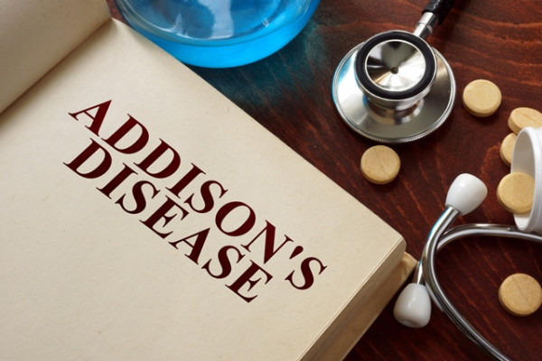 Boala Addison: cauze, simptome si tratament Boala Addison: cauze, simptome si tratament