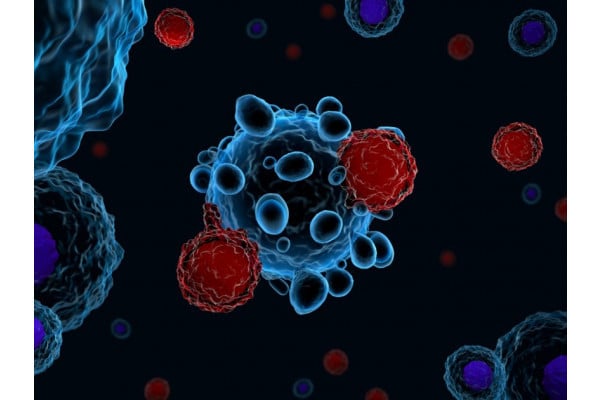 Cancer Pulmonar (cancer la plamani) - Simptome & Tratament | DOC.RO