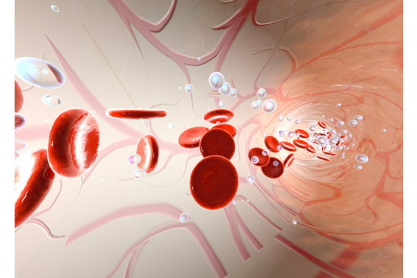 Limfoamele maligne non Hodgkin