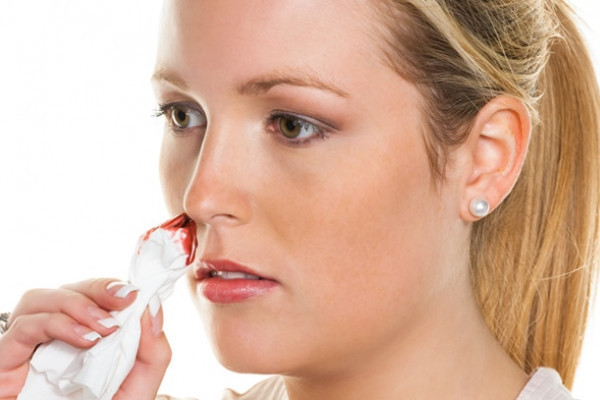 Remedii naturale pentru sangerarile nazale