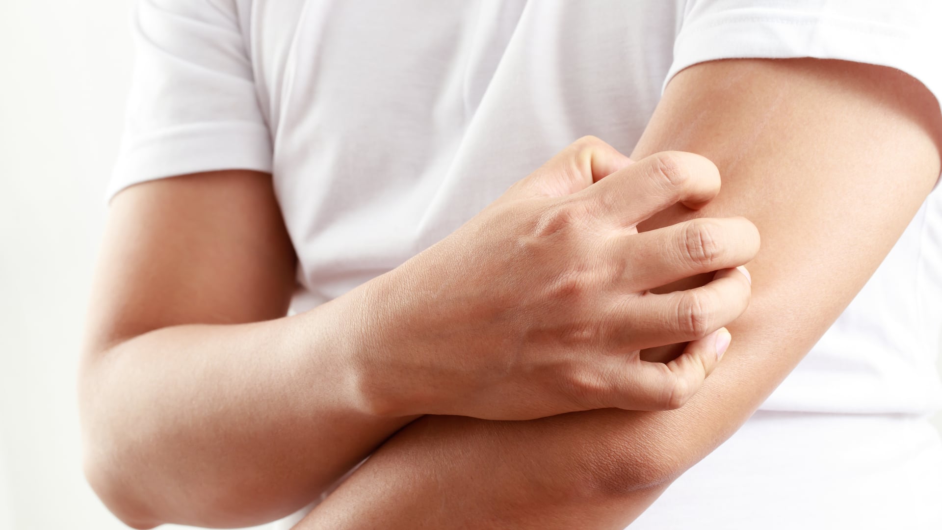 Ce este parapsoriazisul si cum se trateaza?