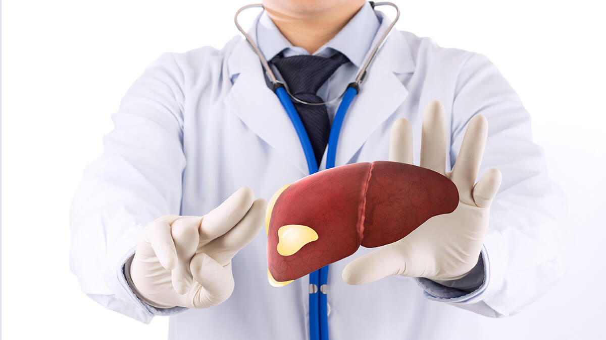 Steatoza hepatică: cum se manifestă și cum se tratează