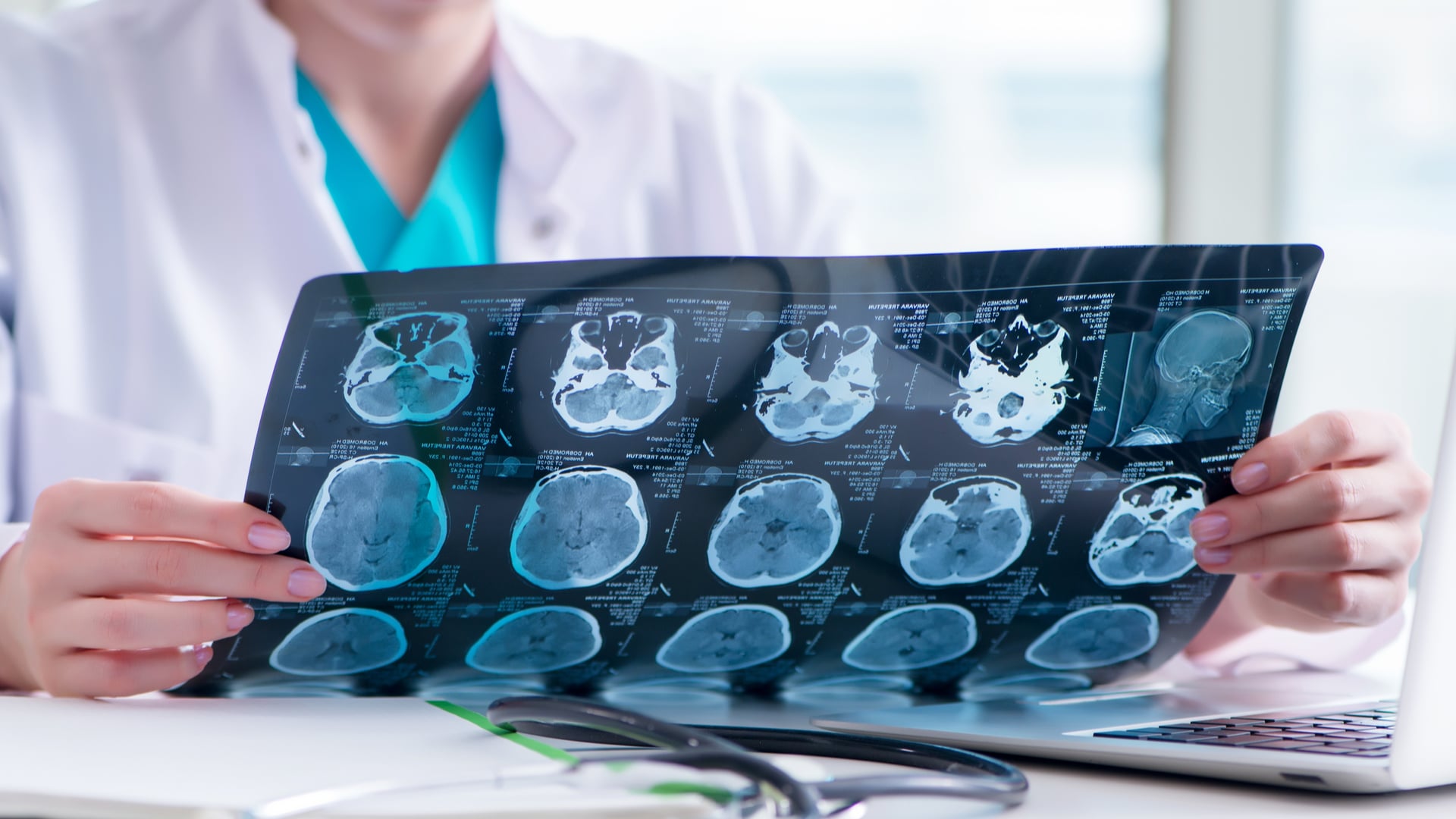 Evaluarea pacientului cu accident vascular cerebral (AVC)