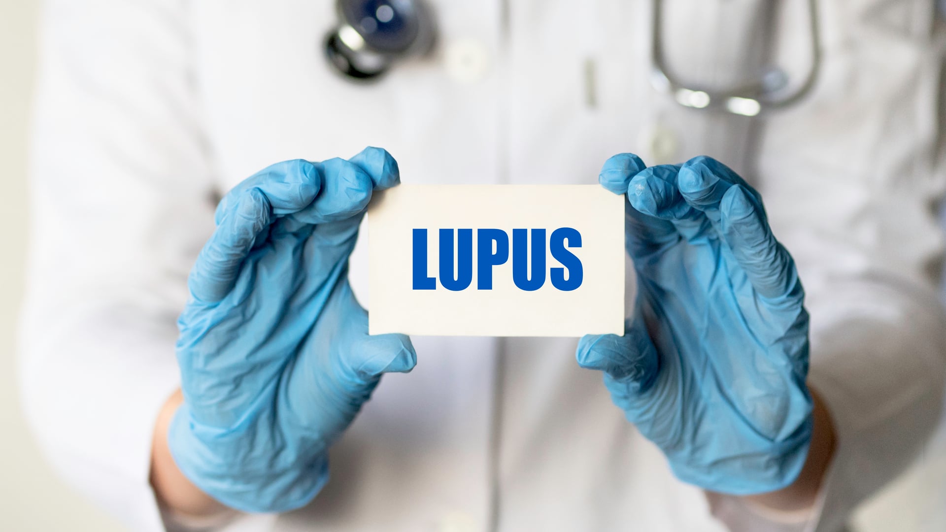 7 mituri despre lupus, DEMONTATE