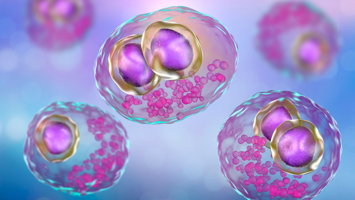 Citomegalovirus (CMV) - ce este, simptome, diagnostic și complicații