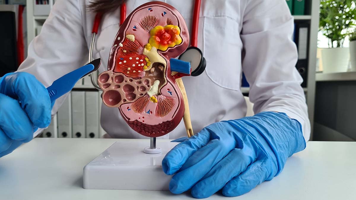 Viata dupa nefrectomie