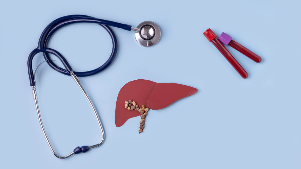 Steatoza hepatica alcoolica: cand apare si cum se trateaza