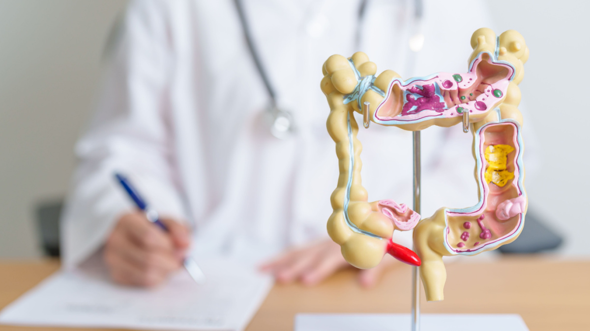 Boala Crohn vs colita ulcerativa - asemanari si deosebiri