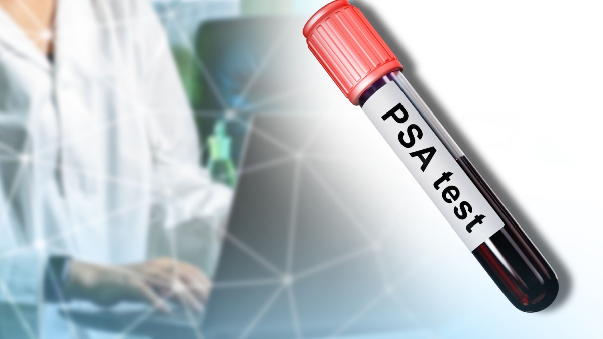 Antigenul prostatic specific (PSA) - instrument util în screening-ul ...