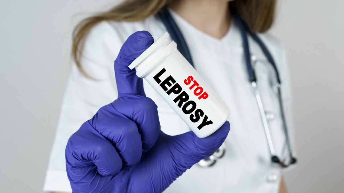 Totul despre lepră: simptome, diagnostic, tratament